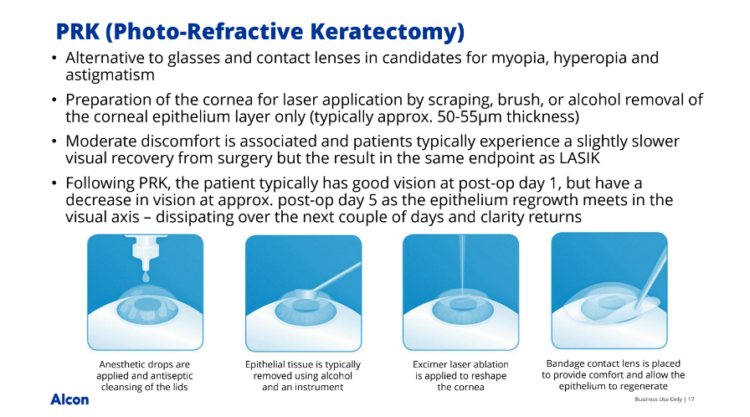 LASIK Alternatives Altoona | Laser Vision Correction Brookville, PA ...