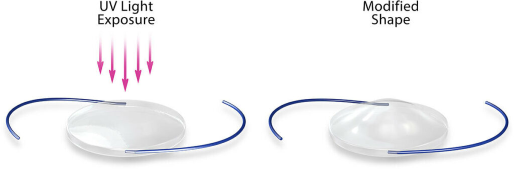 Light Adjustable Lens | Laurel Eye Clinic